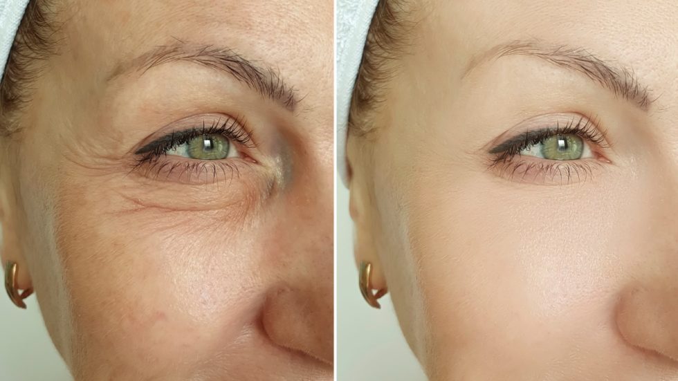 Tempsure Envi - HM Advanced Skin & Lash Spa